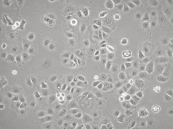 OVCAR-3 Human Ovarian Cancer Cell Line | SCC257